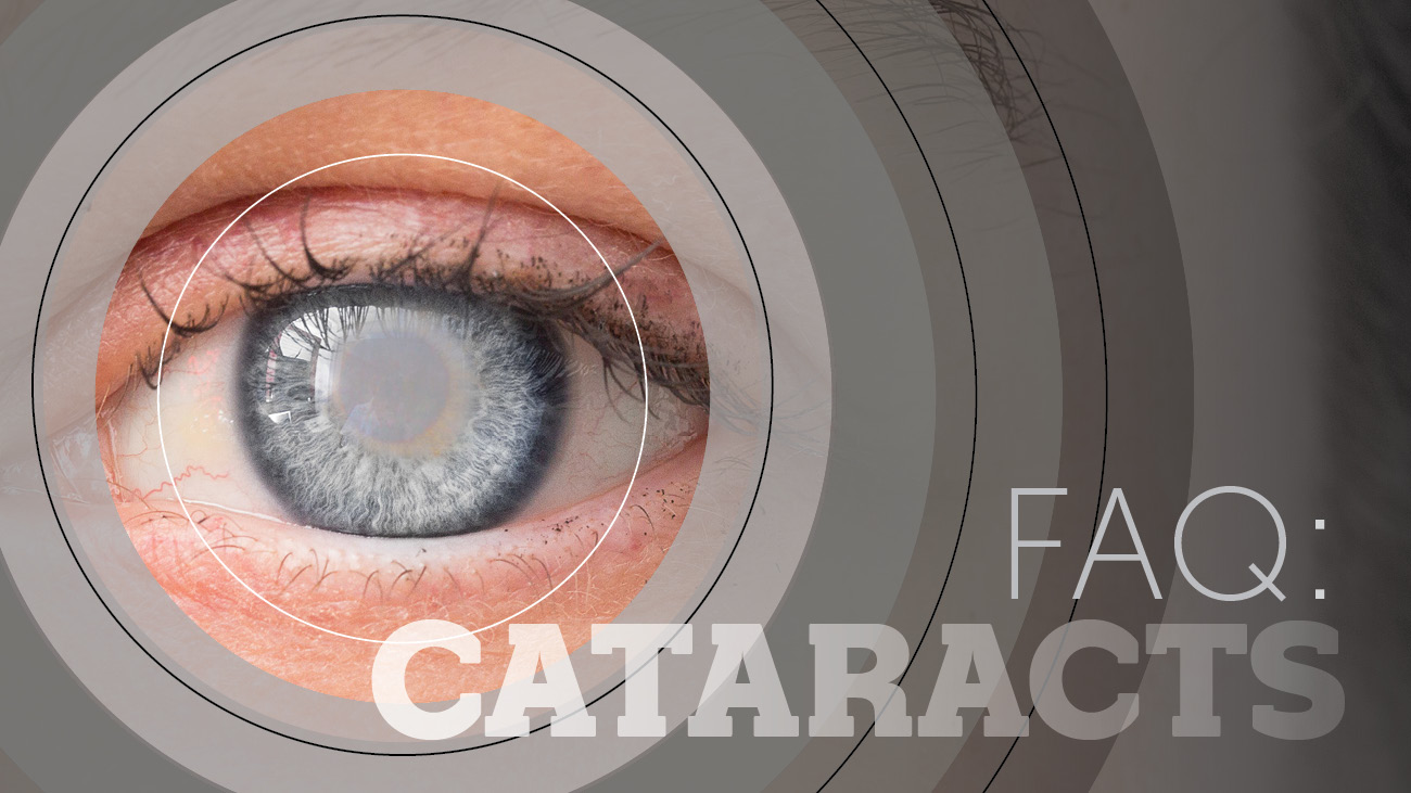 Cataract Treatment | Our Most Frequently Asked Cataract Questions